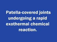 Exploding Knees: Image Gallery | Know Your Meme